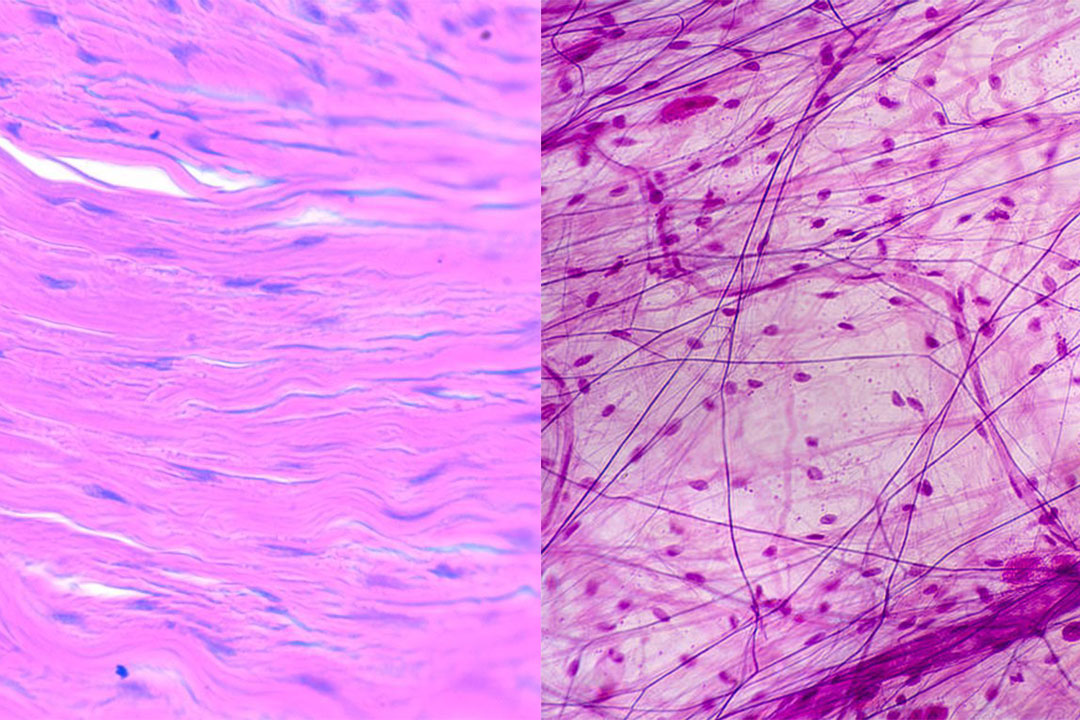 The Tissue That Connects Our Muscles May Be a Key to Better Health ...